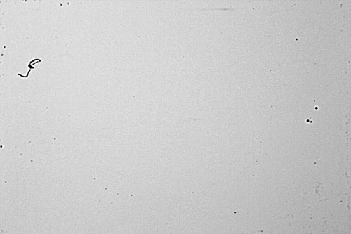 Does this black dot in the image mean that I need to clean the sensor ...